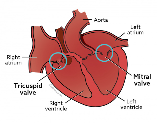 Atrioventricular Valve Dysplasia in Dogs | VCA Animal Hospital